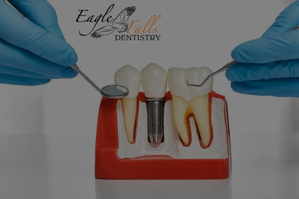 10 Common Dental Implant Mistakes Everyone Makes