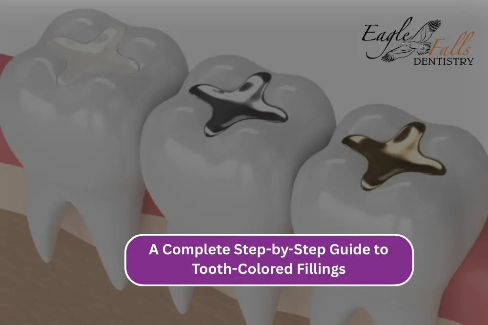 A Complete Step-by-Step Guide to Tooth-Colored Fillings